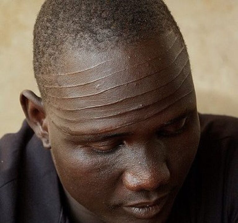 Why Africans scarred themselves for thousands of years - Afrinik